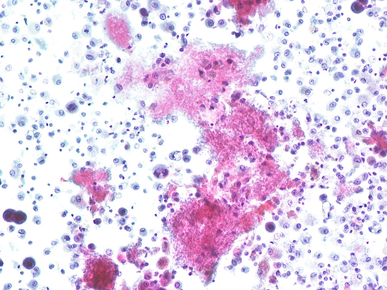 Pulmonary Cytology – Saudi Society of Cytotechnology and Histotechnology