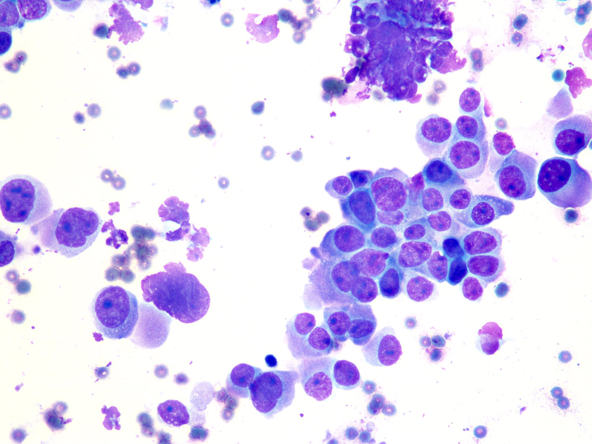 Salivary gland FNA – Saudi Society of Cytotechnology and Histotechnology